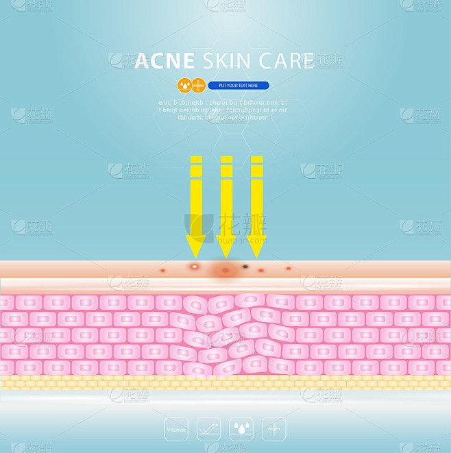 acne skin spot pimple problem vector design.