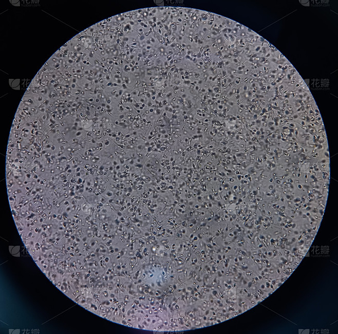 精子的形态。显微镜下精液照片。显微照片显示精子，正常精子症和无精子症与感染的比较。