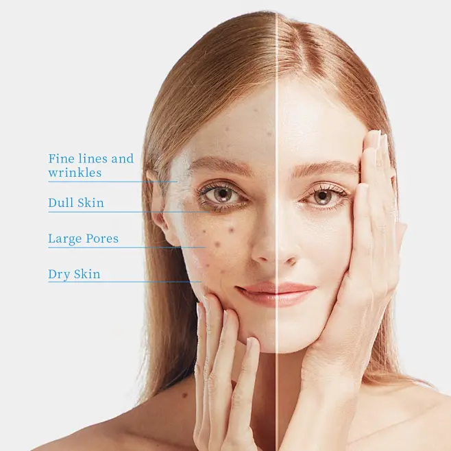 Amazon.com: WIS Moisturizing 4-Piece Skin Care Set with Facial Cleanser ...