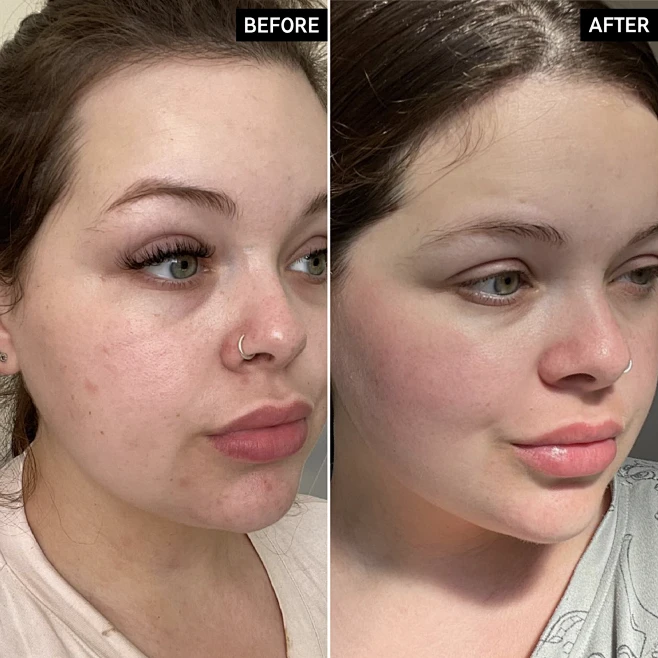 Before and After of customer using Omega Water Cream-花瓣网